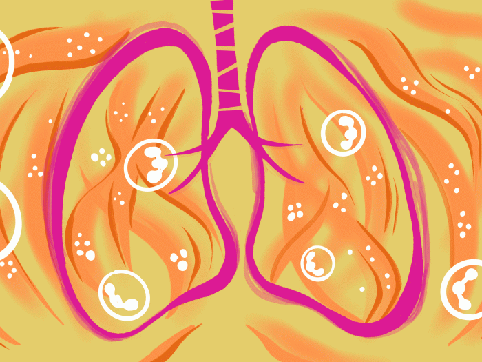 Scleroderma Peer Mentor Program | University of Michigan Health