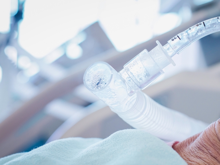 Pneumothorax | University of Michigan Health