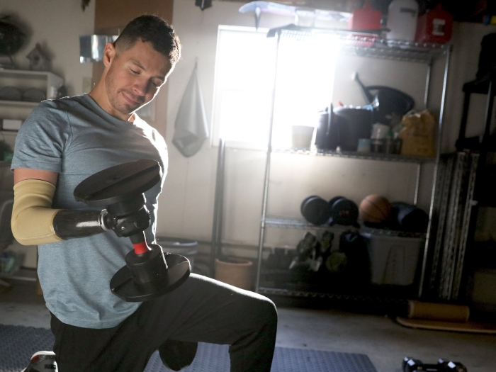 Total Joint Replacement | University of Michigan Health