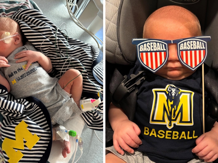 Surgical Aortic Valve Replacement (SAVR) | University of Michigan Health