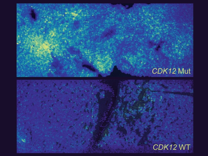 Post-Void Dribble | University of Michigan Health