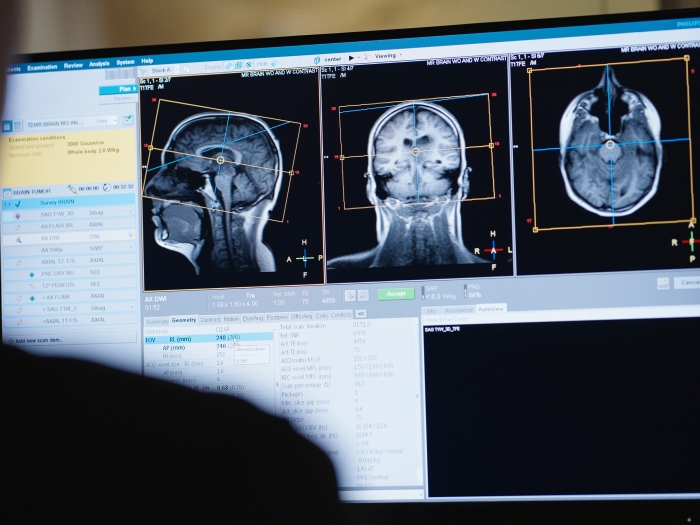 Multidisciplinary Brain Tumor Clinic | University of Michigan Health