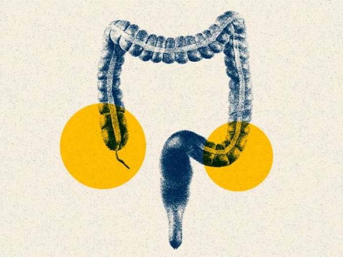 Pouchoscopy | University of Michigan Health