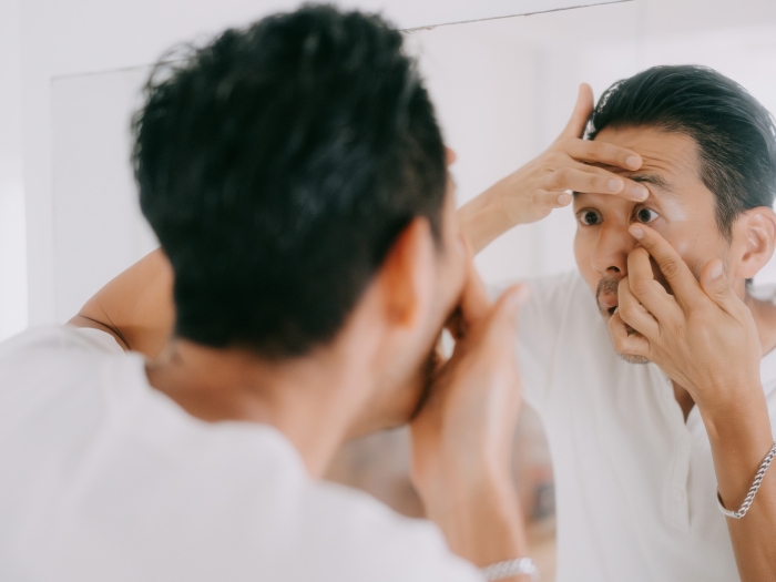 Eyelid Spasms (Eye Twitching or Eye Twitch) | University of Michigan Health