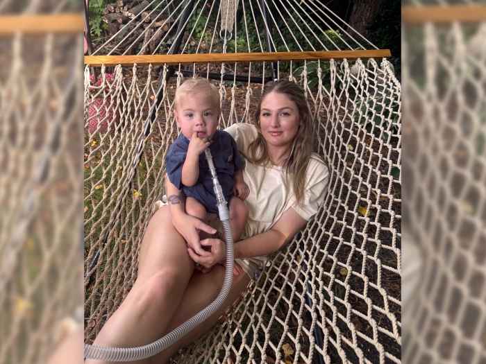 Congenital Diaphragmatic Hernia (CDH) | University of Michigan Health