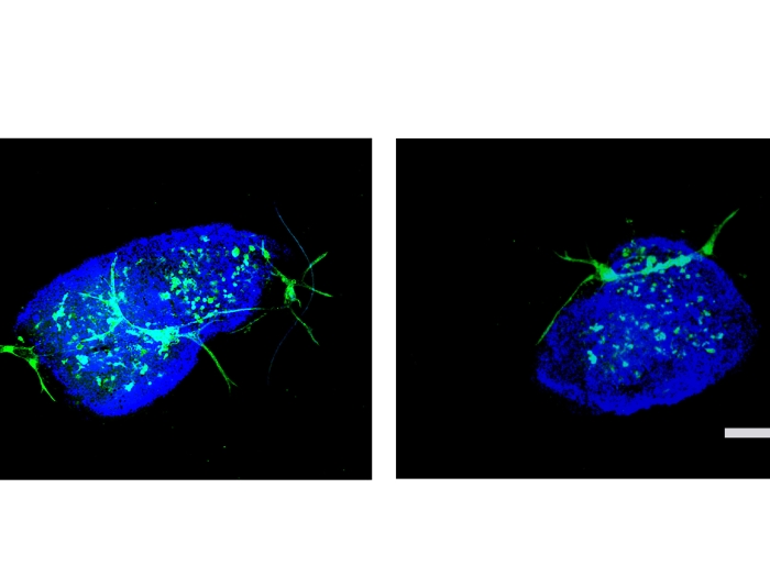 Floaters & Flashes | University of Michigan Health