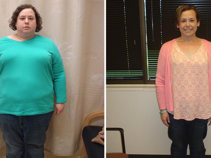 Bariatric Surgery | University of Michigan Health