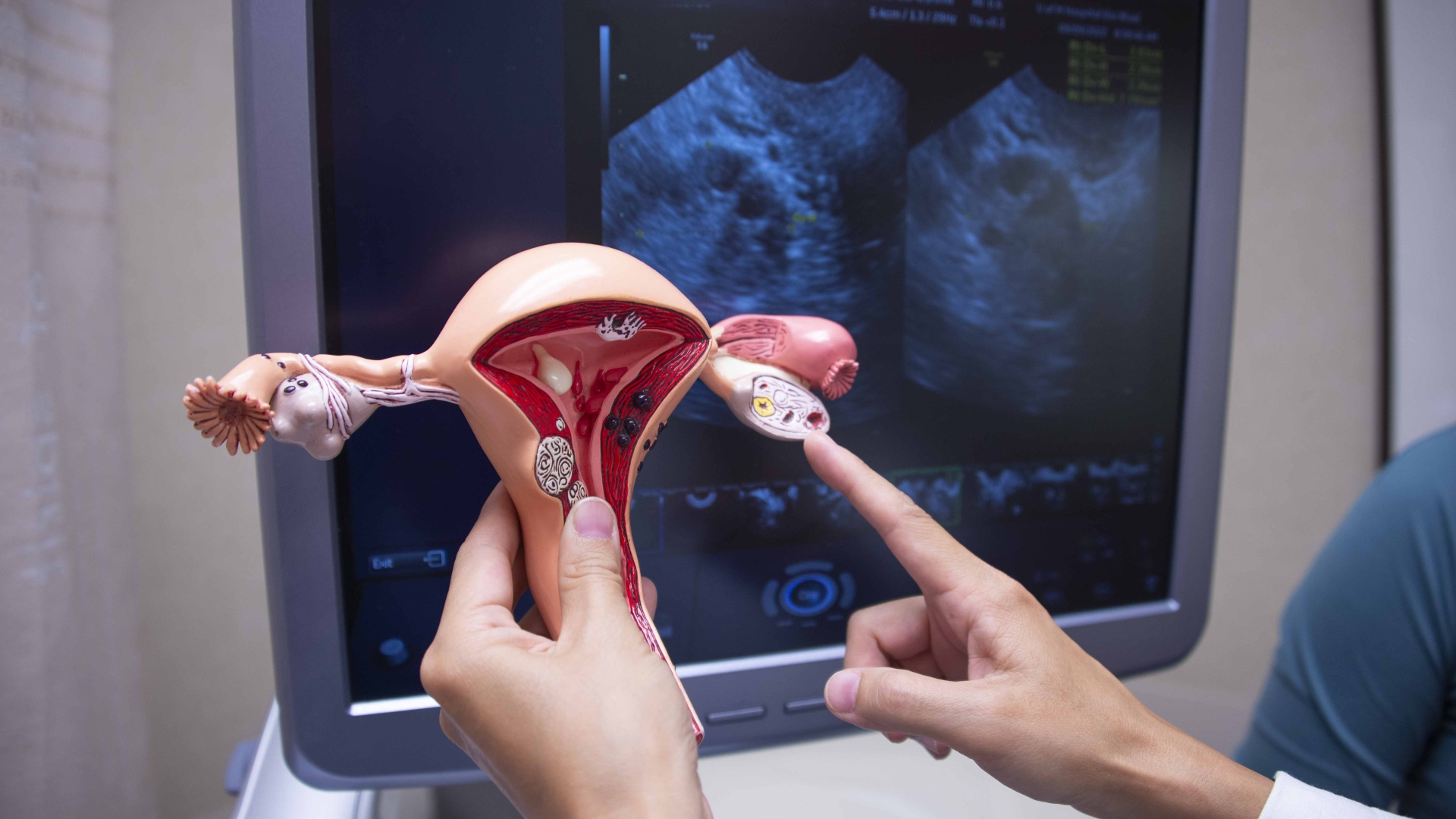 Von Voigtlander Women's Hospital | University of Michigan Health