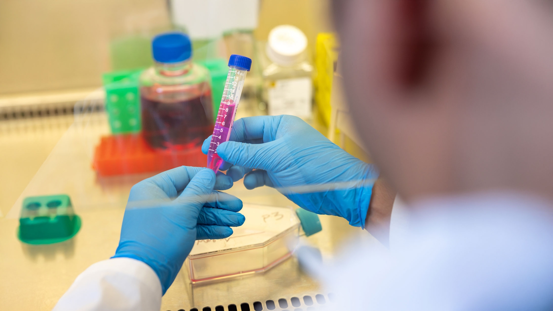 Infectious Diseases | University of Michigan Health