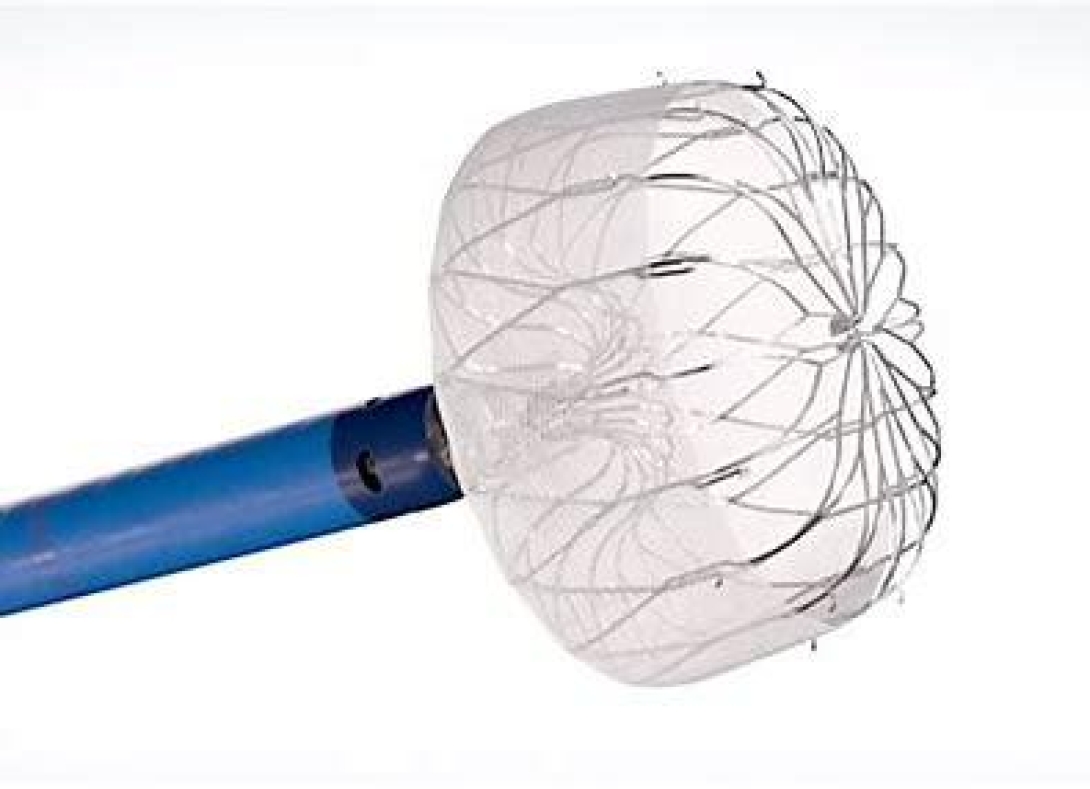 Left Atrial Appendage Occlusion (LAAO) | University of Michigan Health